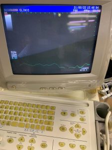 GE LOGIQ 400 PRO CW – Tokyo Medical Company